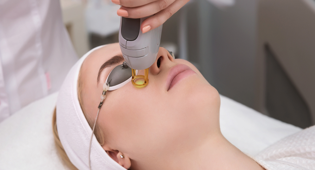 Vascular Laser Treatment for Redness | The Skin Center